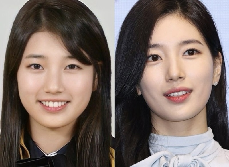 Netizens Wonder About Suzy's Stunning Visual Transformation: "What Did She Do?" - Netizenbuzz